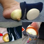 The Surprising Benefits of Placing an Onion in a Sock – Lets Cook